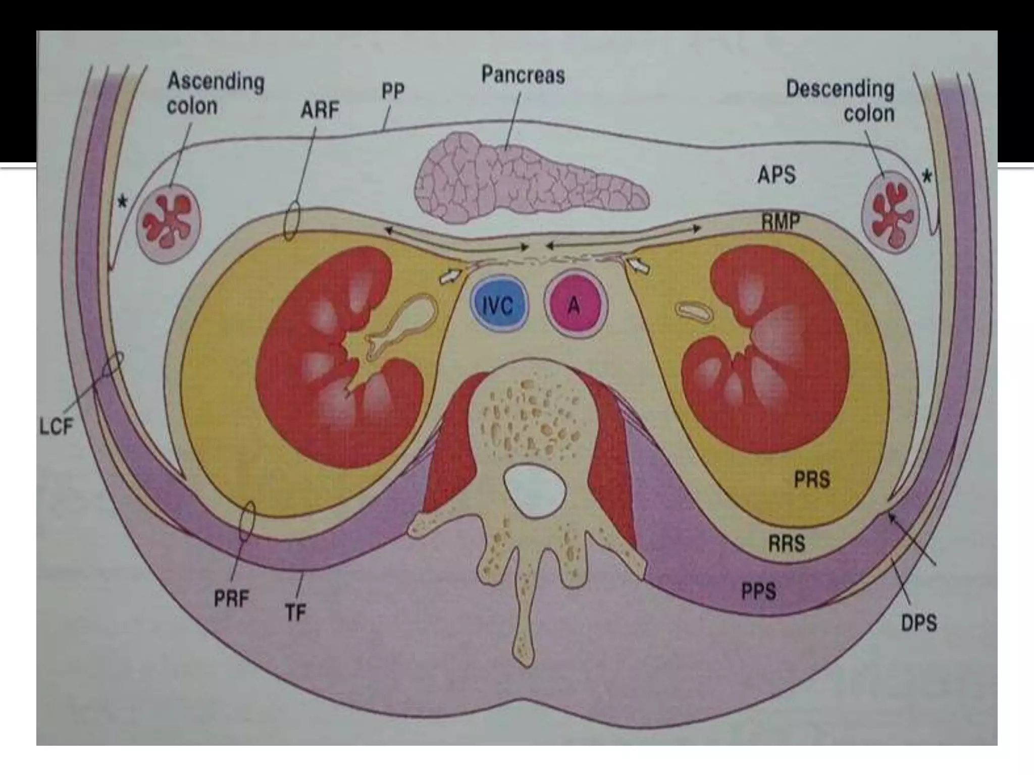 Retroperitoneal space | PPTX