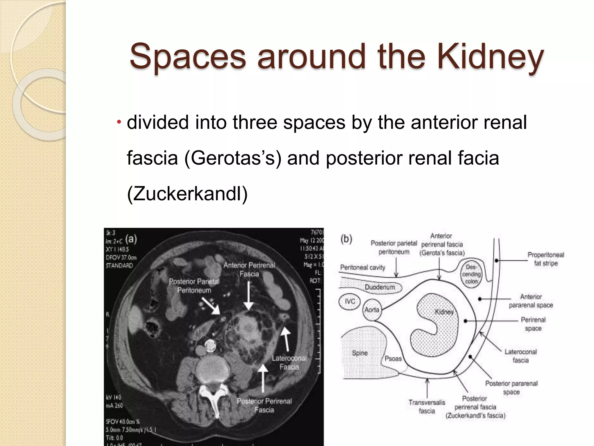 Retroperitoneal Space of the Kidney.pptx