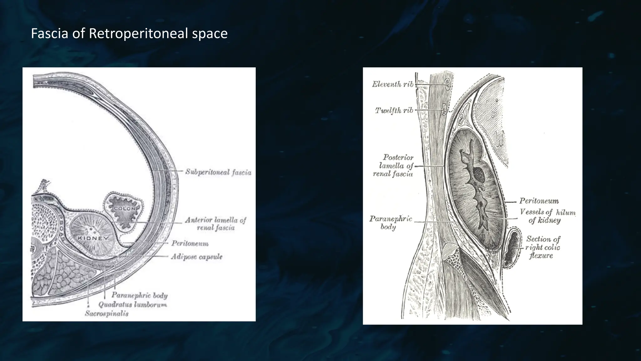 Clinical anatomy of the retroperitoneal space. Vessels and nerves of ...
