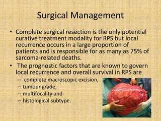 Retroperitoneal tumours | PPT