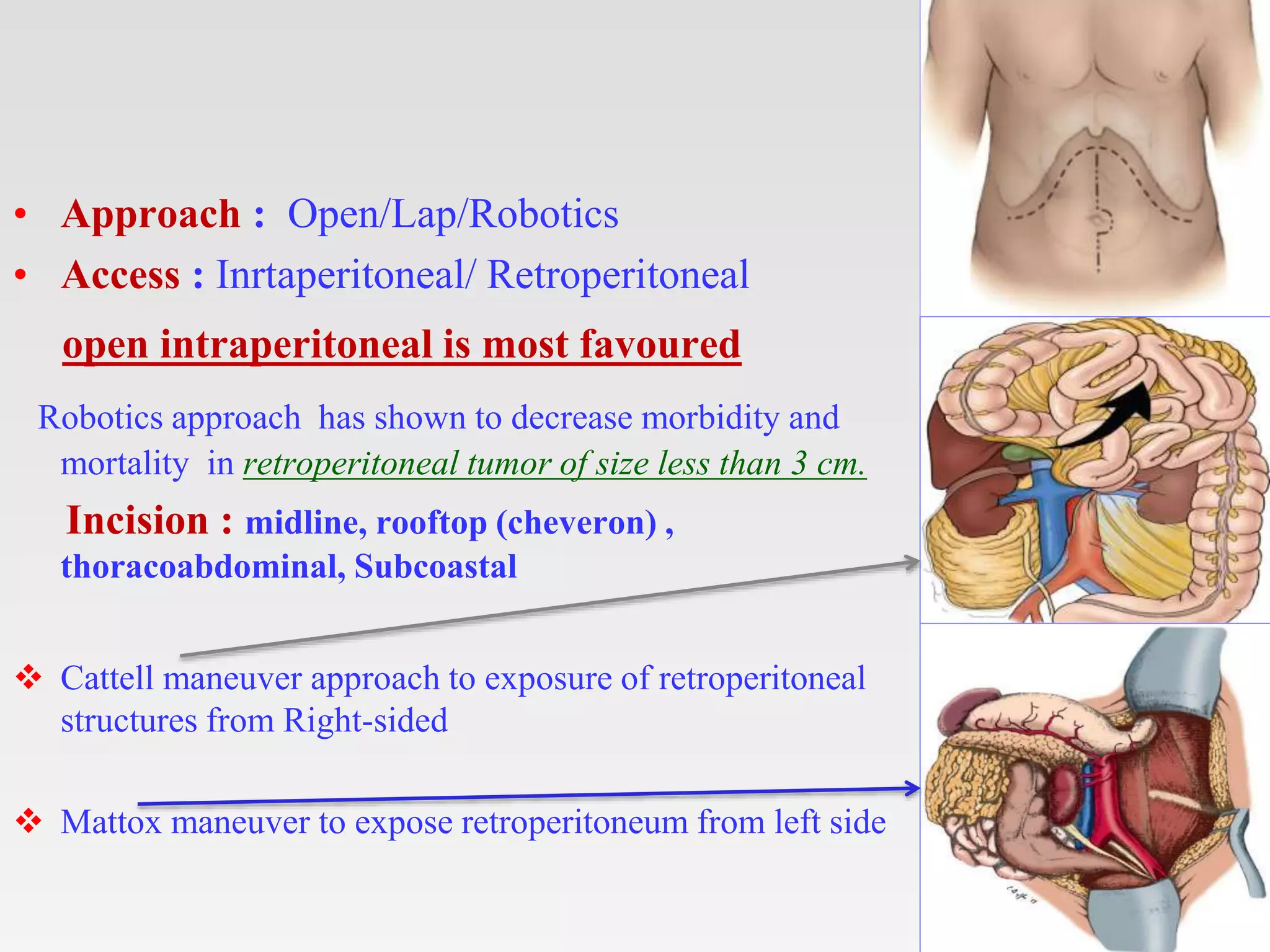 Retroperitoneal tumours.pptx | Cancer | Diseases and Conditions