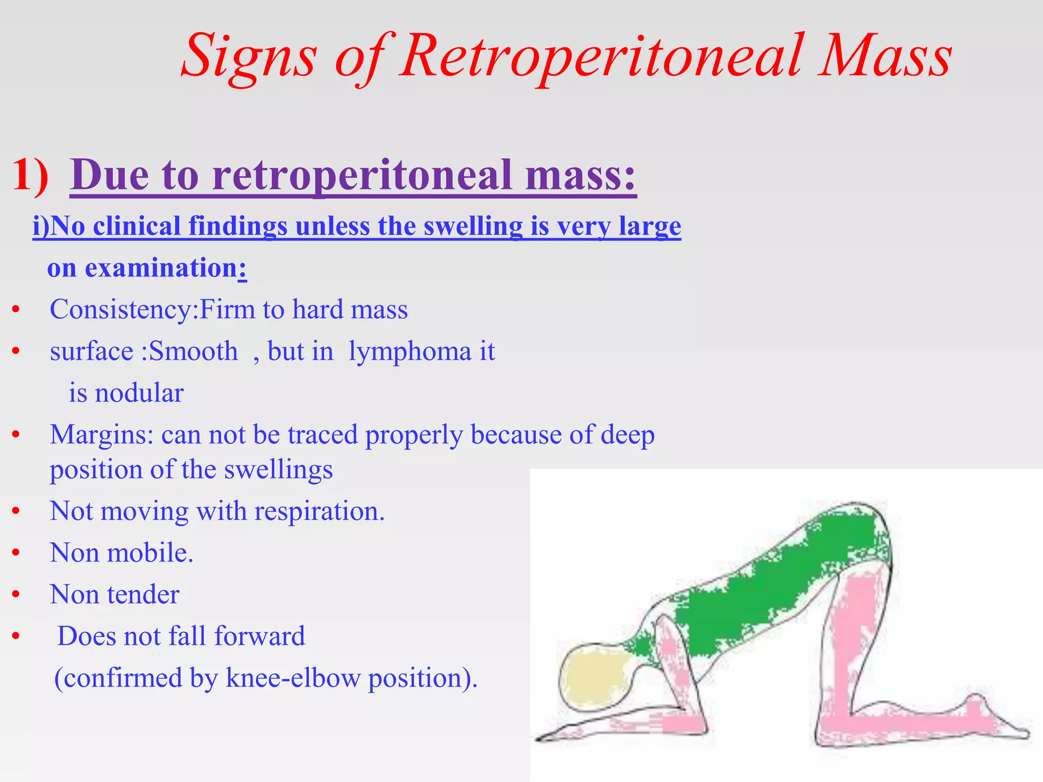 Retroperitoneal tumours.pptx | Cancer | Diseases and Conditions