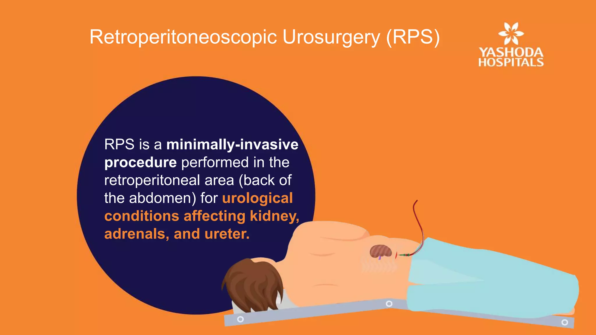 What is Retroperitoneoscopic Surgery | PPTX