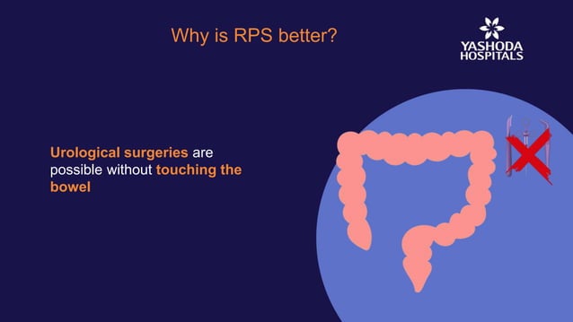 What is Retroperitoneoscopic Surgery | PPT