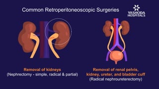 What is Retroperitoneoscopic Surgery | PPT