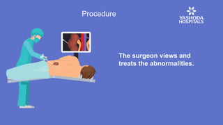 What is Retroperitoneoscopic Surgery | PPT
