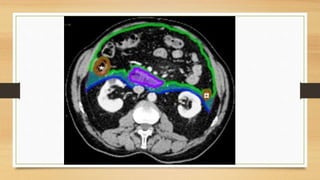 Retroperitoneum | PPTX