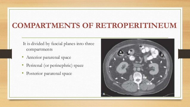 Retroperitoneum