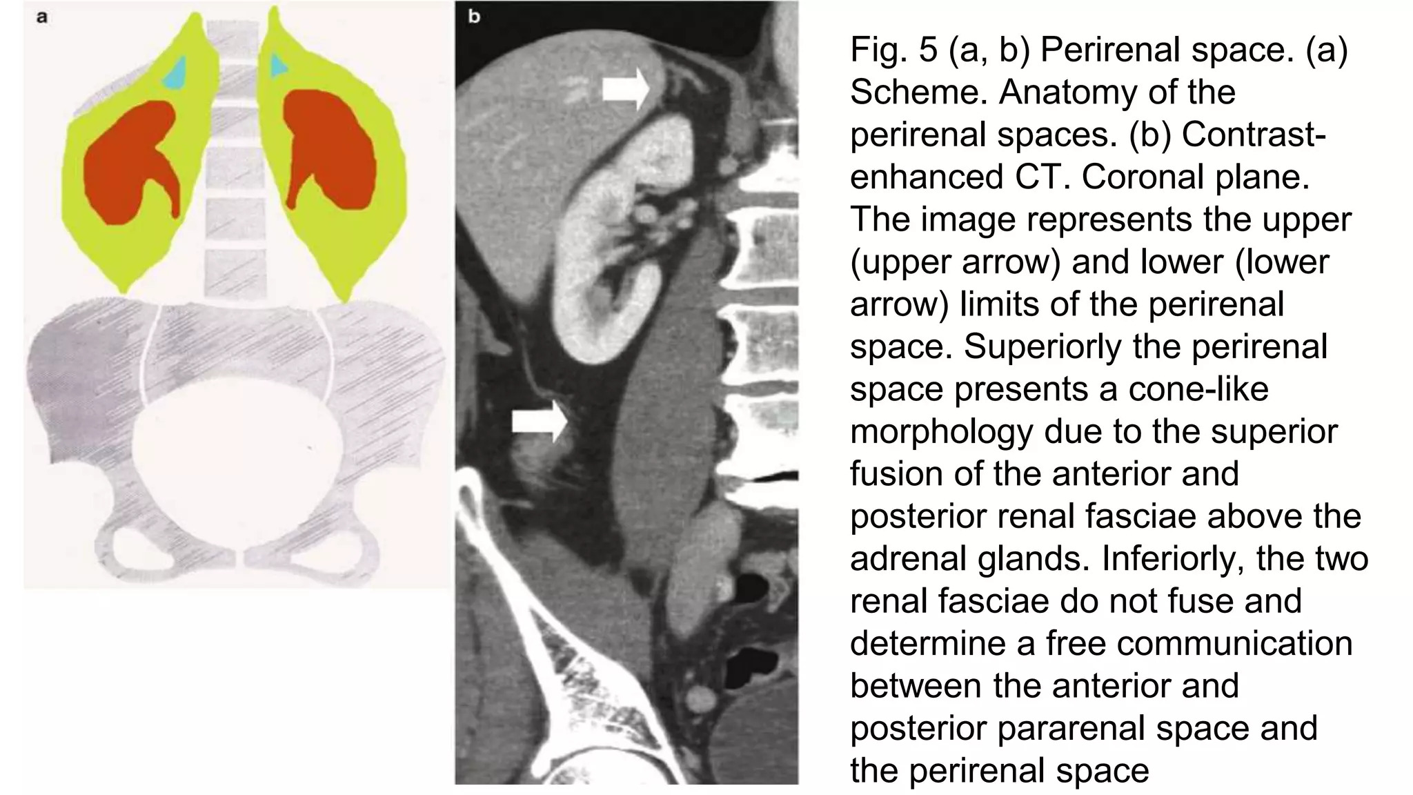 Anatomy of Retroperitoneum. | PPTX