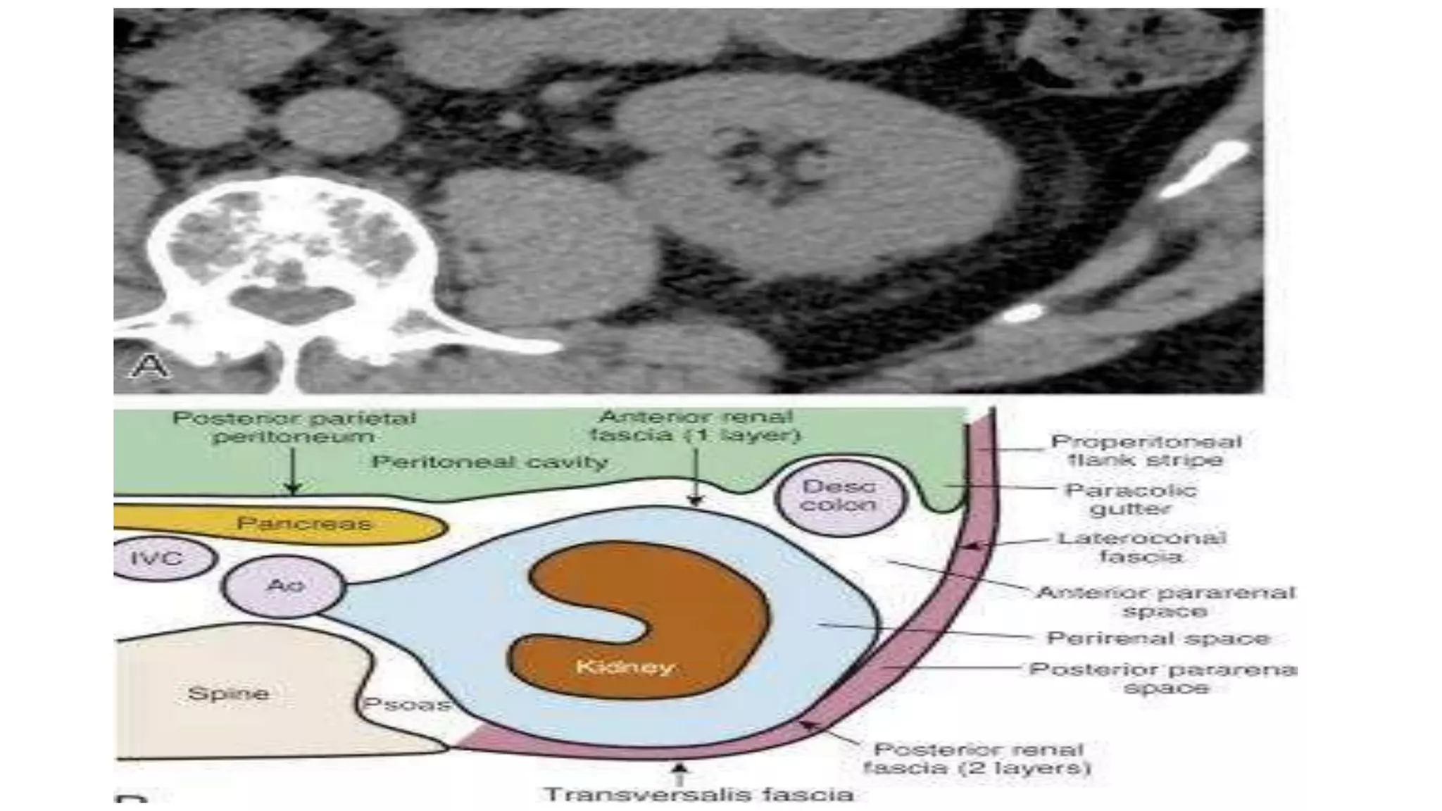 Anatomy of Retroperitoneum. | PPTX