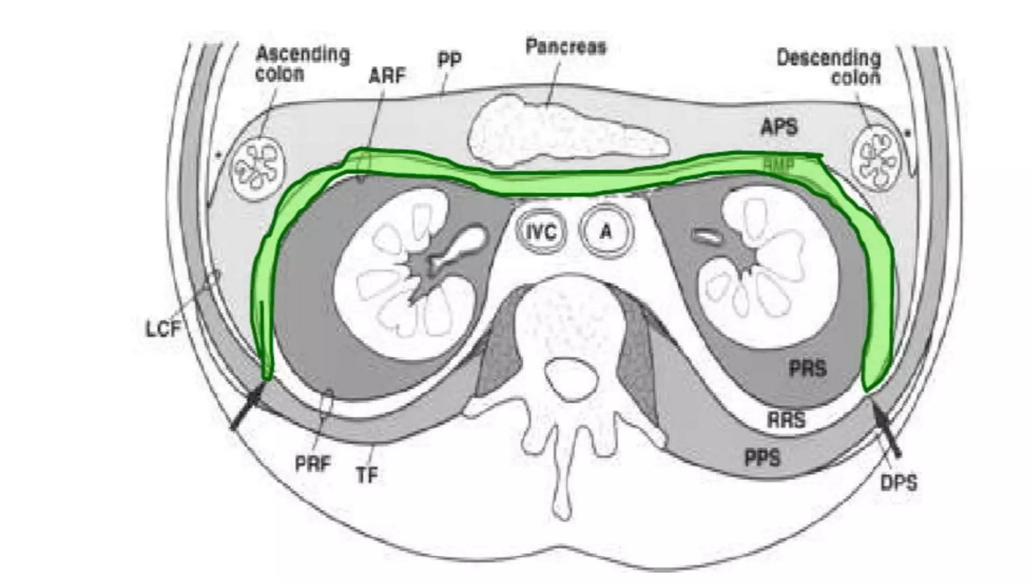 Anatomy of Retroperitoneum. | PPTX