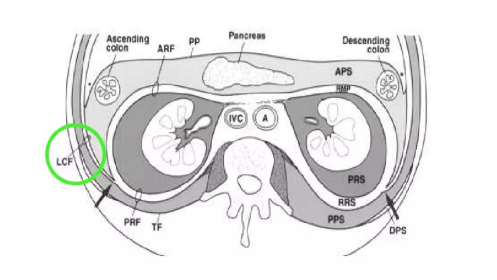 Anatomy of Retroperitoneum. | PPTX