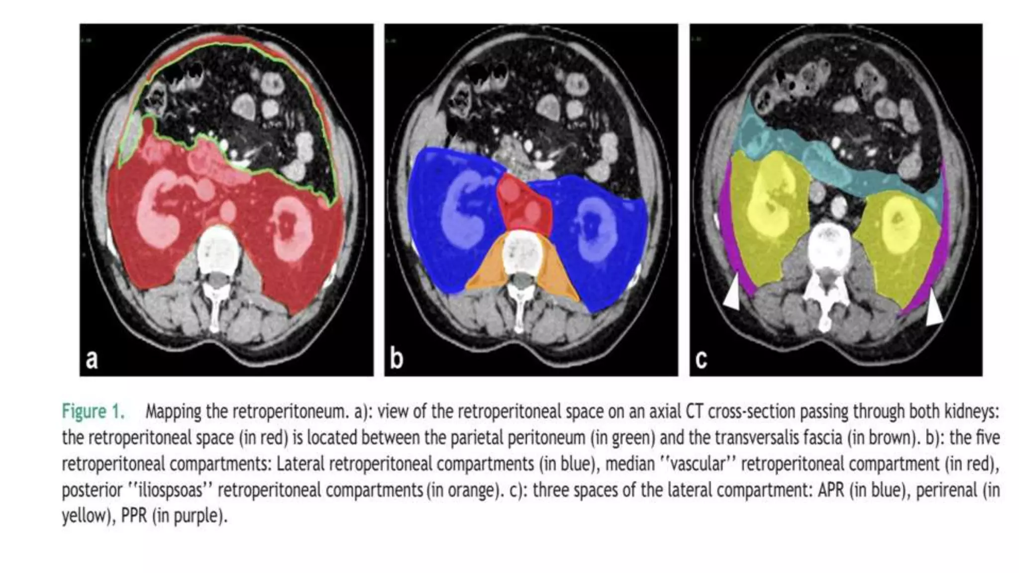 Anatomy of Retroperitoneum. | PPTX