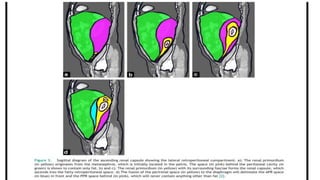 Anatomy of Retroperitoneum. | PPTX