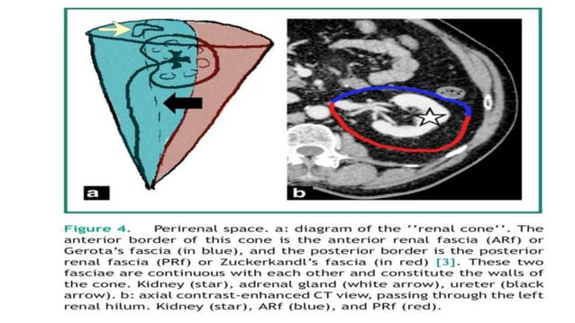 Anatomy of Retroperitoneum. | PPTX