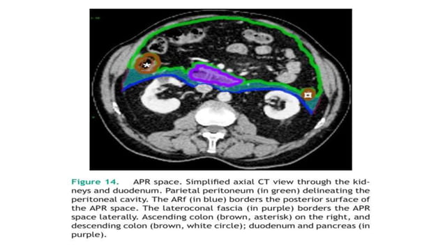 Anatomy of Retroperitoneum. | PPTX