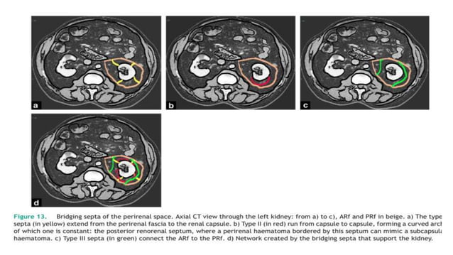 Anatomy of Retroperitoneum. | PPTX