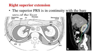 Anatomy of Retroperitoneum. | PPTX