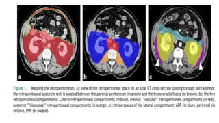 Anatomy of Retroperitoneum. | PPTX