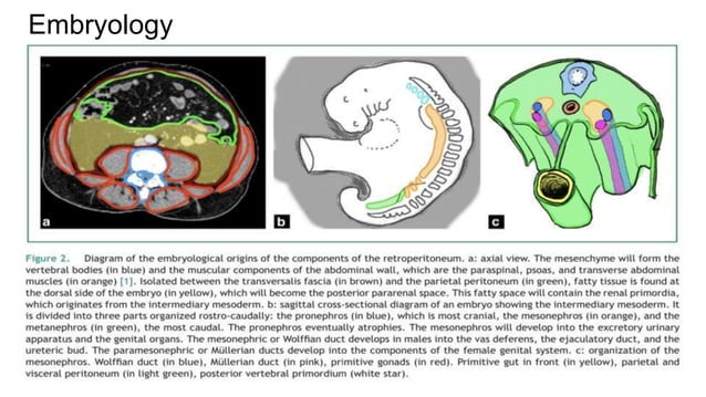 Anatomy of Retroperitoneum. | PPTX