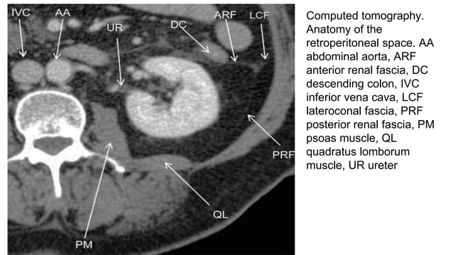 Anatomy of Retroperitoneum.
