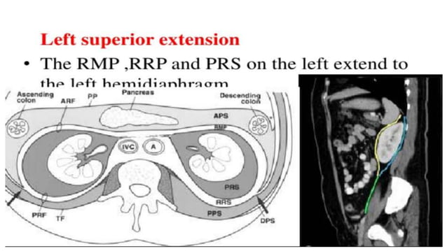 Anatomy of Retroperitoneum.