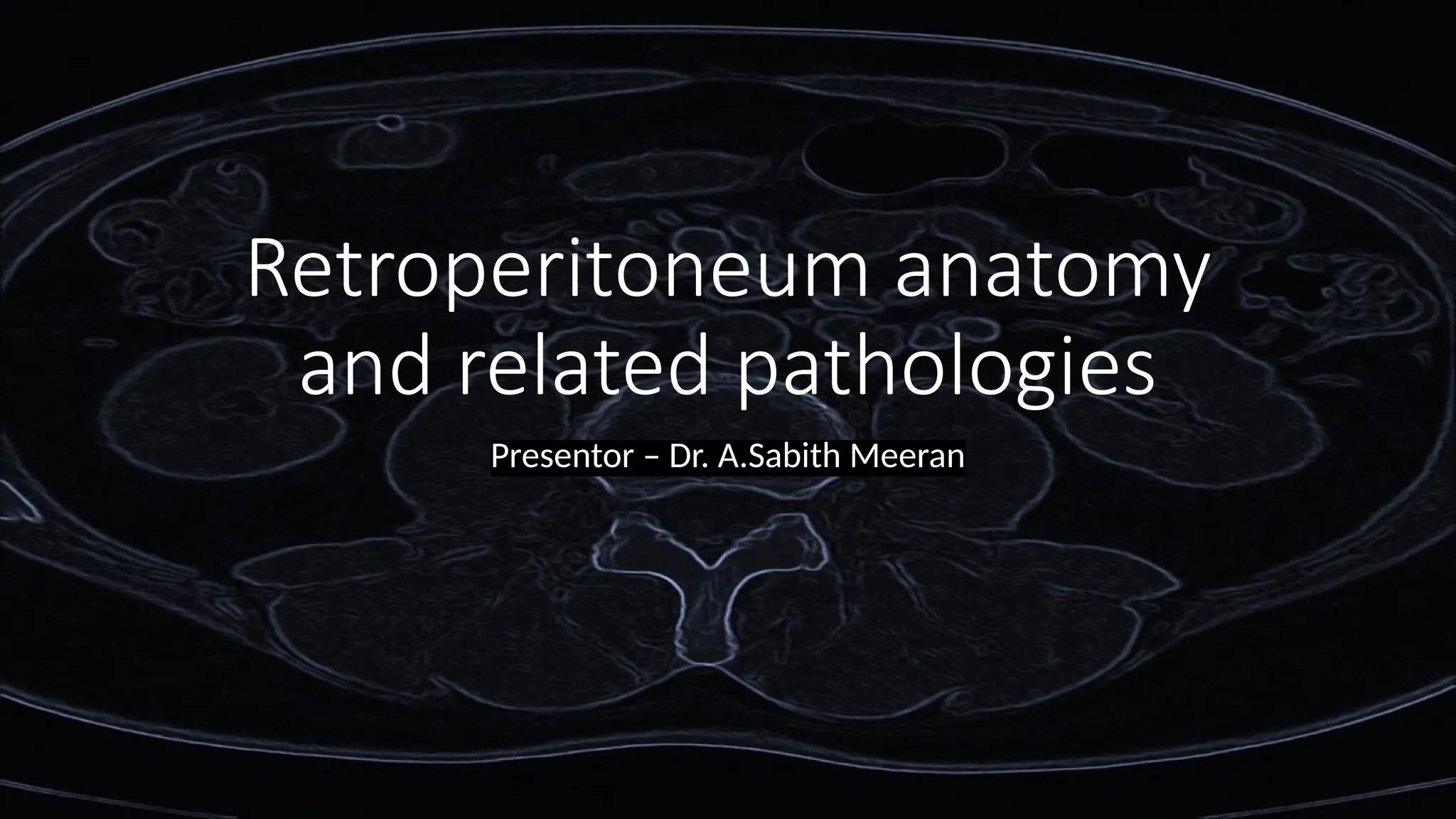 Retroperitoneum anatomy by Dr. A.Sabith Meeran , MD Radiodiagnosis | PPTX