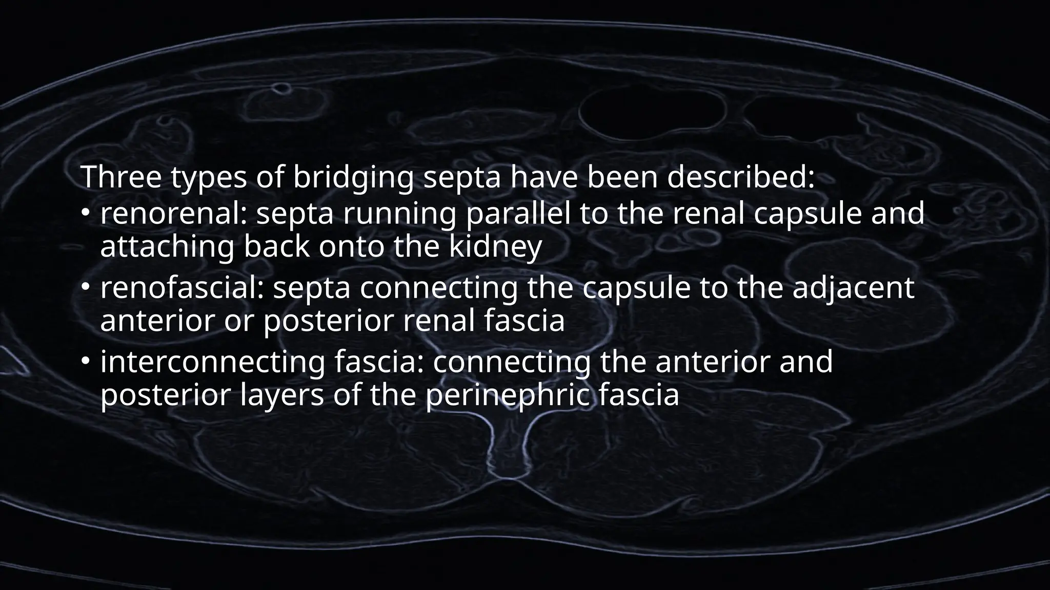 Retroperitoneum anatomy by Dr. A.Sabith Meeran , MD Radiodiagnosis | PPTX