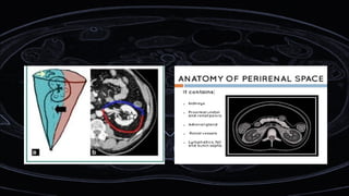 Retroperitoneum anatomy by Dr. A.Sabith Meeran , MD Radiodiagnosis | PPTX