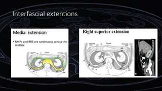 Retroperitoneum anatomy by Dr. A.Sabith Meeran , MD Radiodiagnosis | PPTX