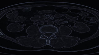 Retroperitoneum anatomy by Dr. A.Sabith Meeran , MD Radiodiagnosis | PPTX