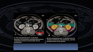 Retroperitoneum anatomy by Dr. A.Sabith Meeran , MD Radiodiagnosis | PPTX