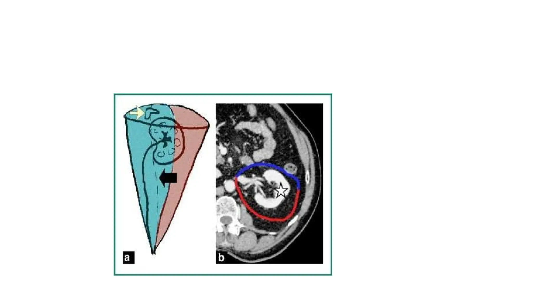 retroperitoneum anatomy radiology (3).pptx