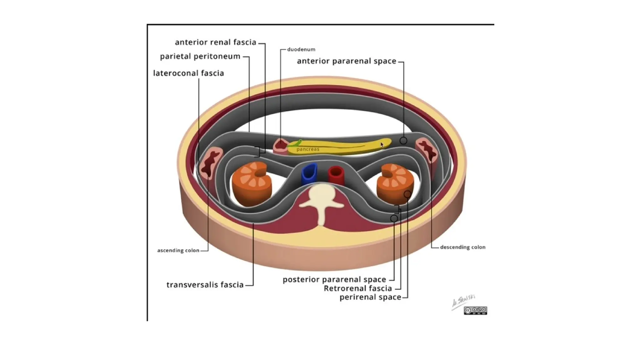 retroperitoneum anatomy radiology (3).pptx