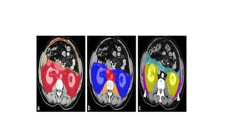 retroperitoneum anatomy radiology (3).pptx