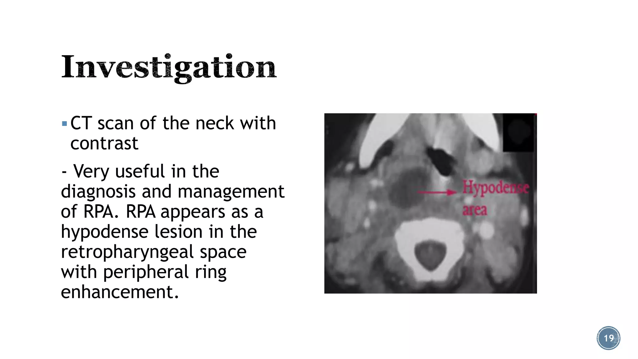 Retropharyngeal Abscess by Boluwatife Afolabi | PPTX