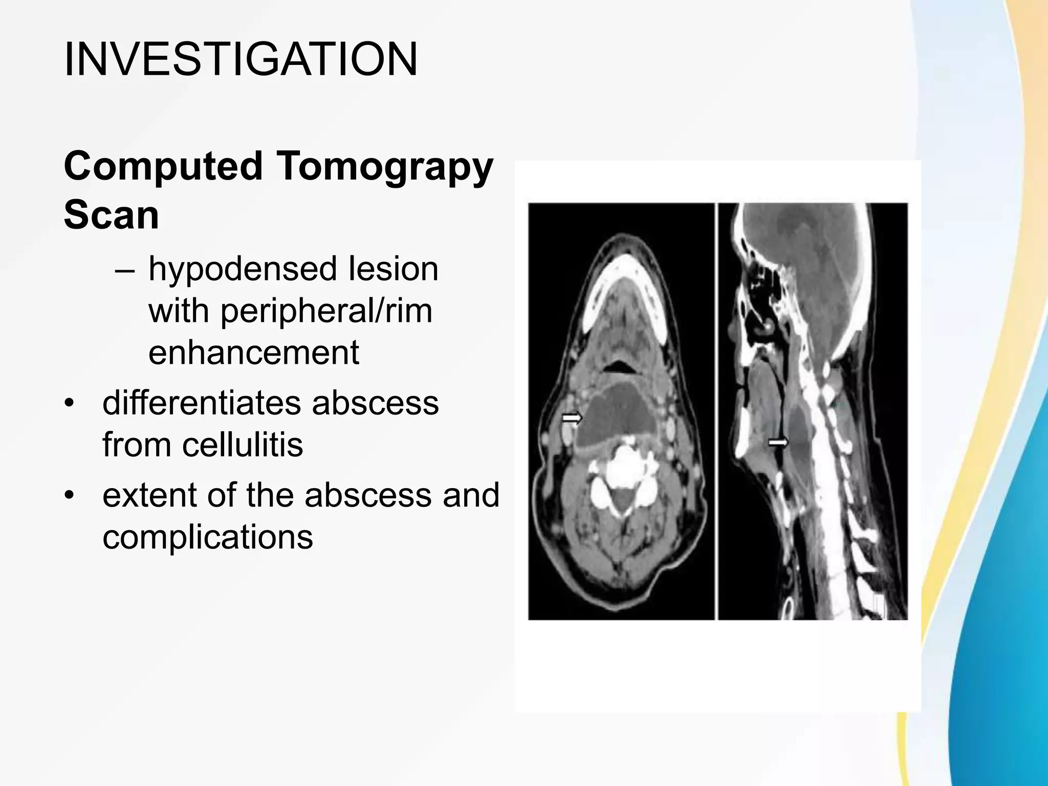 RETROPHARYNGEAL ABSCESS N.pptx