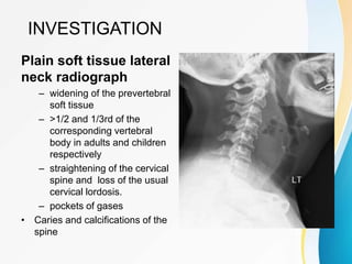 RETROPHARYNGEAL ABSCESS N.pptx