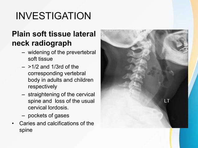 RETROPHARYNGEAL ABSCESS N.pptx