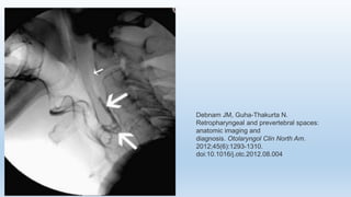 Retropharyngeal space | PPTX