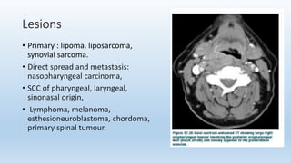Retropharyngeal space | PPTX