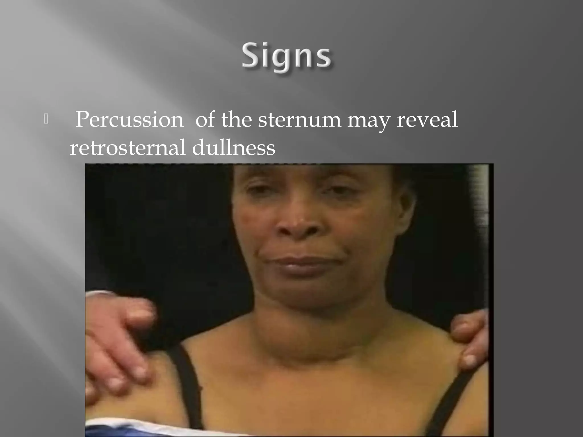 Retrosternal goiter | PPT