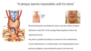 Retrosternal SZISACON aug 11.pptx