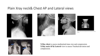 Retrosternal SZISACON anaesthesia periop | PPT