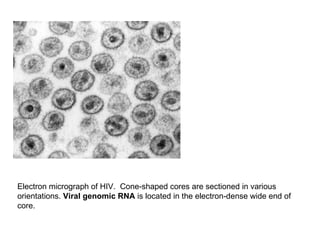 Retroviruses Compressed | PPT | Genetics | Science