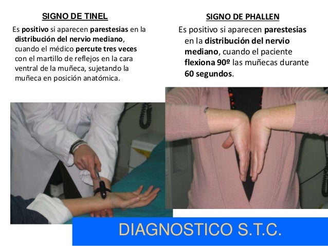 Reumatismos extra articulares – Miembro superior