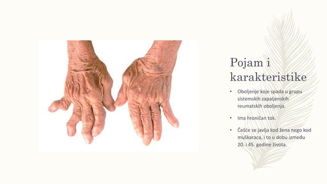 Reumatoidni artritis - interna medicina | PPTX