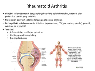 Reumatologi Reumatologi Reumatologi Reumatologi | PDF