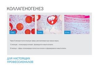 Revanesse presentation | PDF