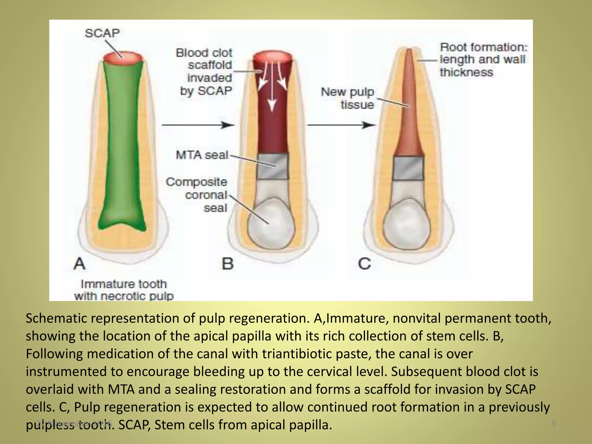 Revascularisation | PPTX